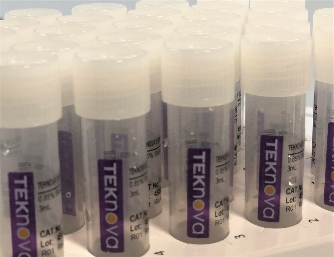 Teknova hiring spurred by COVID-19 | BenitoLink